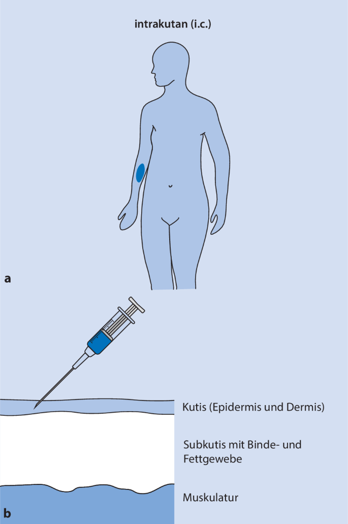 Injektionen und Blutentnahme | SpringerLink
