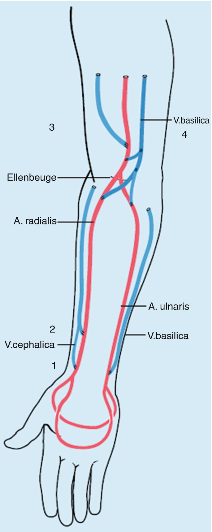 Dialyseshunt: Diagnostik vor Shuntanlage | SpringerLink