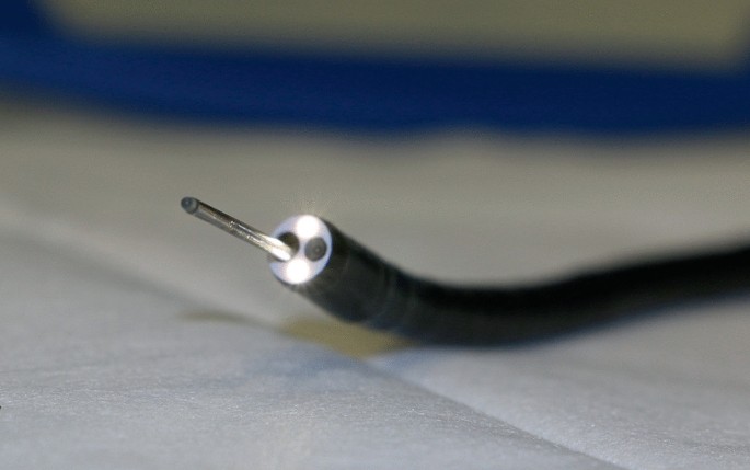 Endobronchialer Ultraschall (EBUS) | SpringerLink