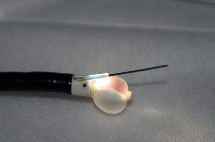 Endobronchialer Ultraschall (EBUS) | SpringerLink
