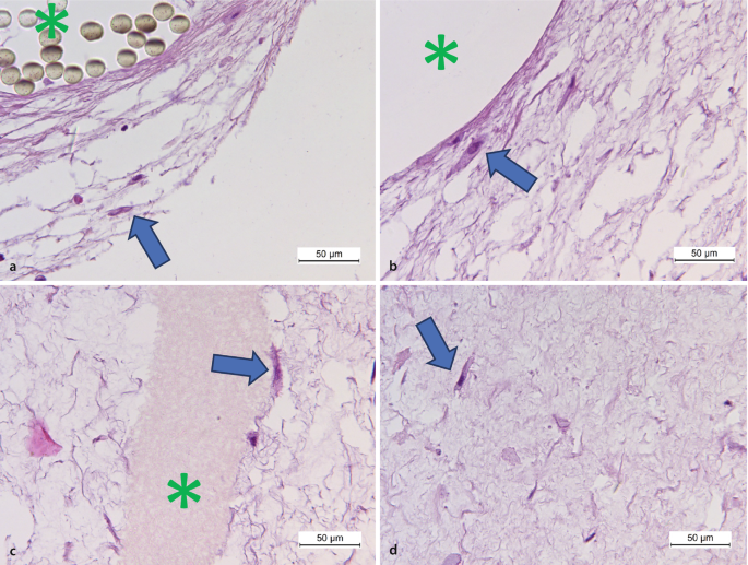 Was denken Fibroblasten über synthetische Netze? Ein Tissue Engineering ...