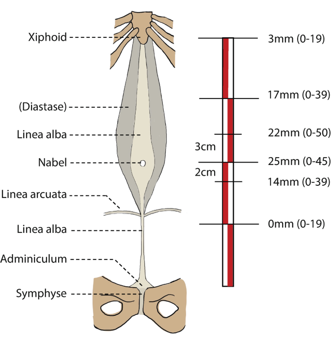 Anatomie der Linea alba | SpringerLink