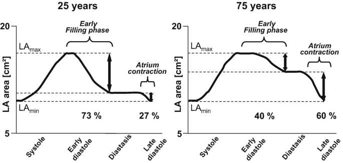 Cardiac Diseases in Old Age | Springer Nature Link