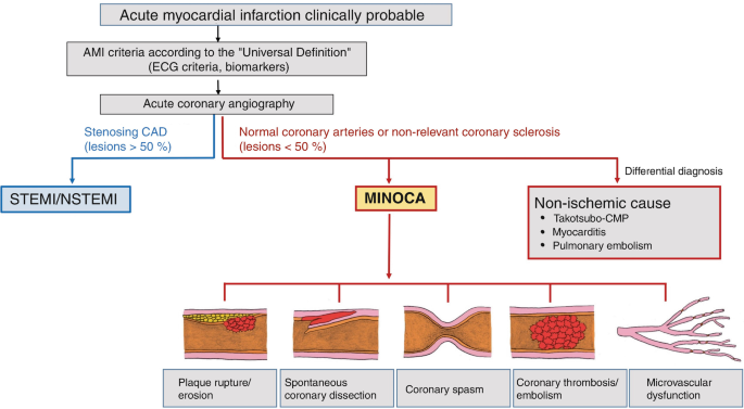 Cardiac Diseases in Women | Springer Nature Link