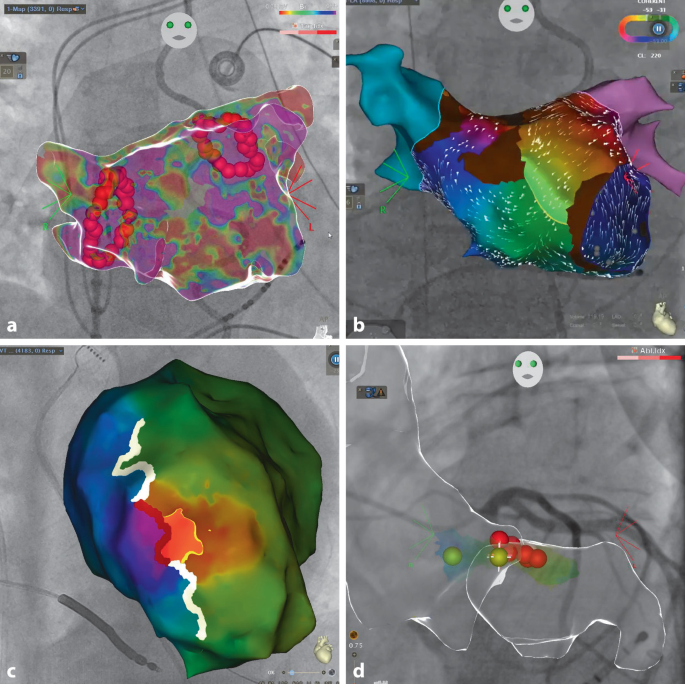 Basis Principles of 3D Mapping Systems | SpringerLink