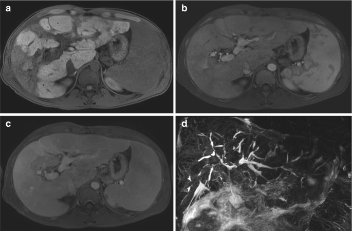 Bildgebende diagnostische Verfahren | SpringerLink