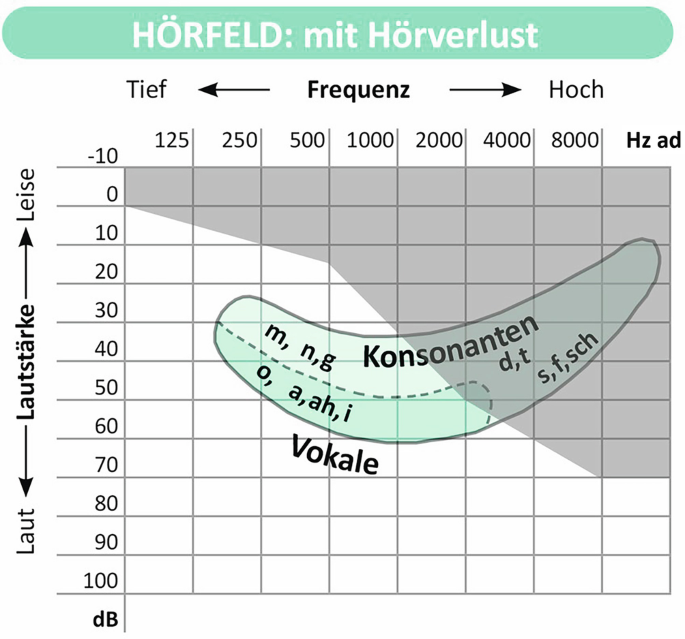 Hörwahrnehmung in Frequenz und Lautstärke und die Sprachbanane ...
