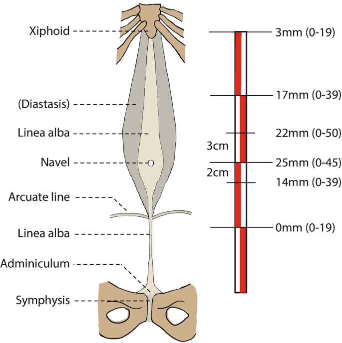 Anatomy of the Linea Alba | SpringerLink