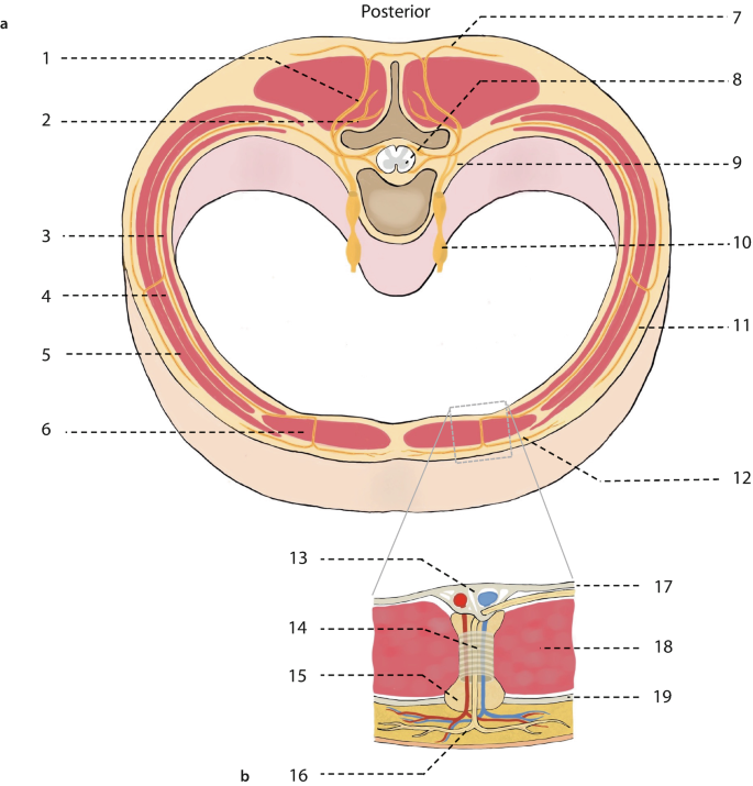 ACNES: A Pain Syndrome of the Abdominal Wall that Simulates Visceral ...
