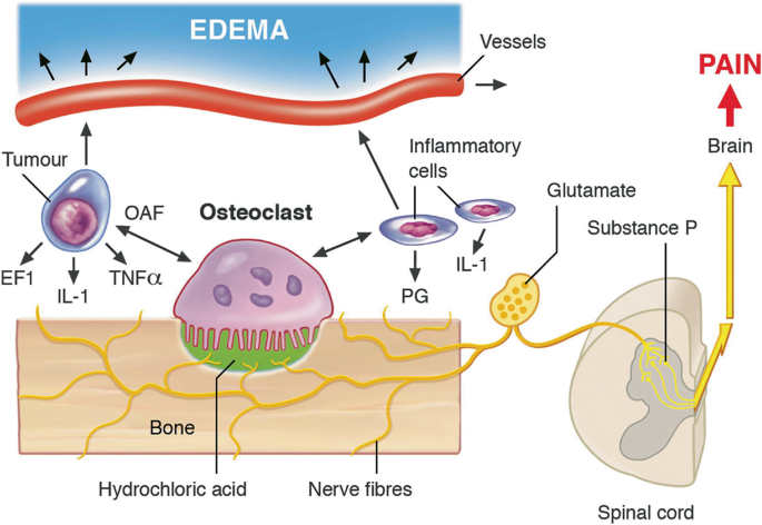 BME and BMES in Orthopedics and Traumatology | SpringerLink