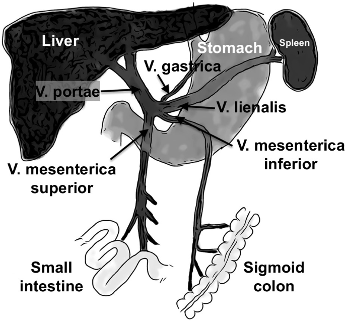 Portal Vein Thrombosis | Springer Nature Link