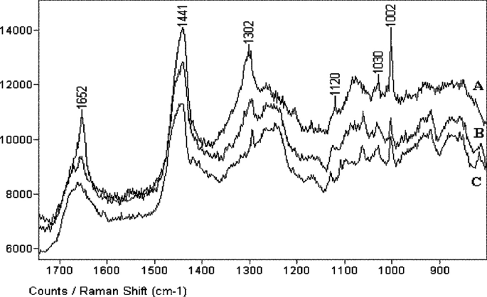 Raman Detection of Collagen Biomarkers | SpringerLink