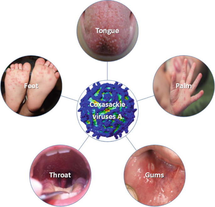 New Disease Called Blue Waffle