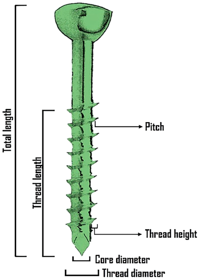 Importance of Orthopaedic Screws | SpringerLink