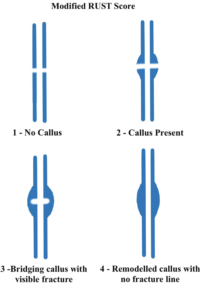 Defining the Clinical and Radiological Endpoint of a Successfully Fixed ...