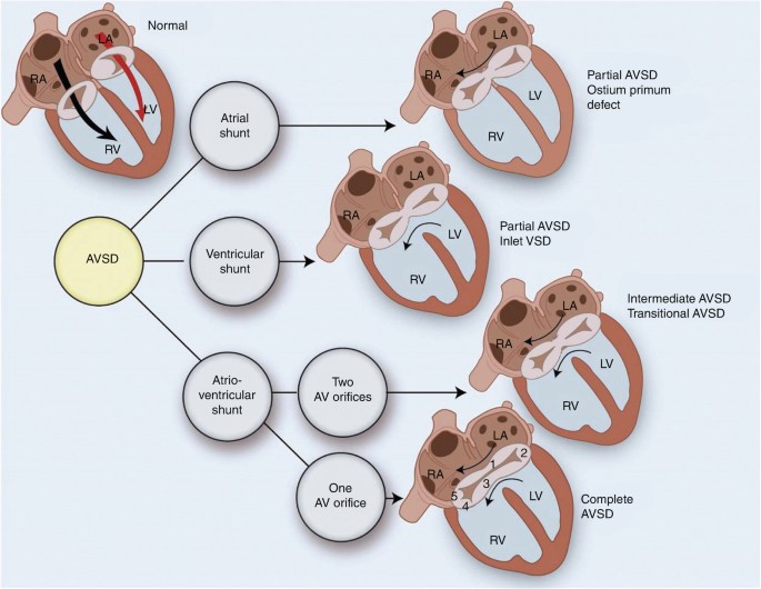 Echocardiographic Evaluation of Congenital Heart Defects | Springer ...