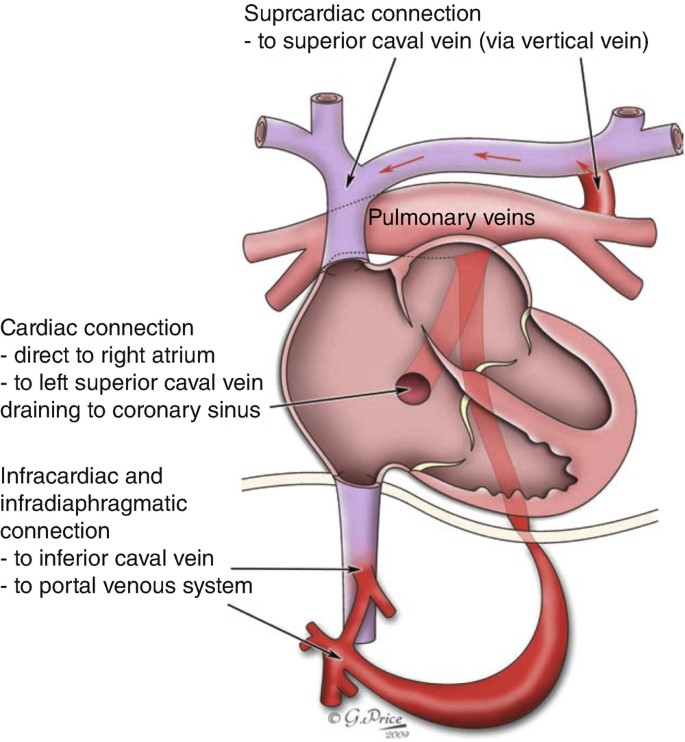 Echocardiographic Evaluation of Congenital Heart Defects | Springer ...