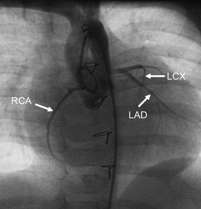 Diagnostic and Interventional Procedures for Coronary Artery ...