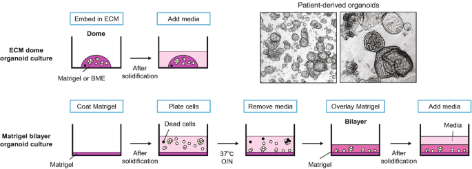 Patient-Derived Organoids: Basic and Translational Research on Uterine ...