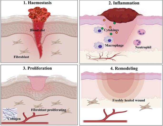 Mechanistic Insights into the Biology of Wound Healing | Springer ...
