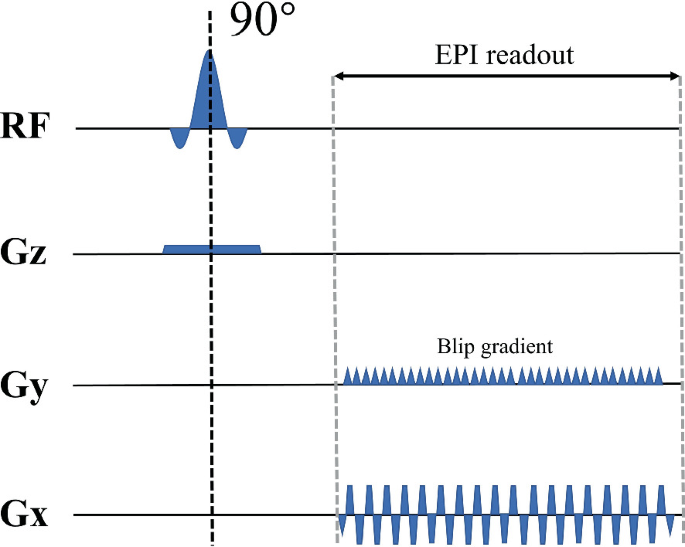 Basics of Diffusion MRI Sequence | SpringerLink