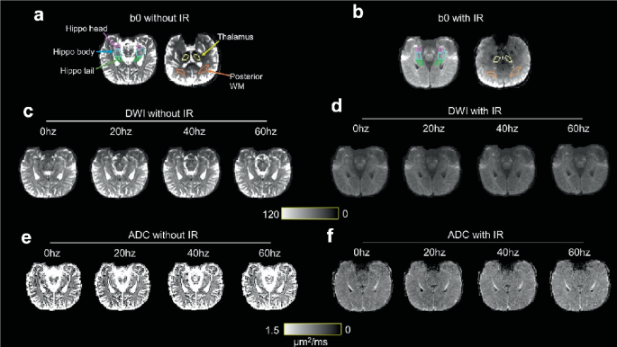 IR-based 3D Gradient and Spin Echo Imaging | SpringerLink