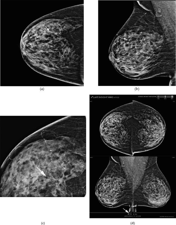 Cancer Imaging and Scope of Early-Stage Diagnosis: Molecular Imaging ...