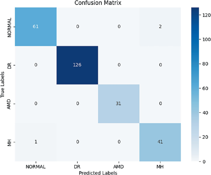 Multimodal Deep Learning for Retinal Disease Diagnosis | SpringerLink