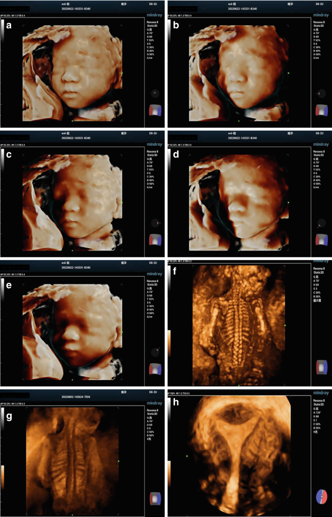 Fundamentals of Ultrasonic Diagnosis and Common Ultrasound Techniques ...