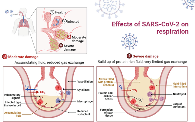 Immunological Persistence and Risk of SARS-CoV-2 Reinfection: Insights ...