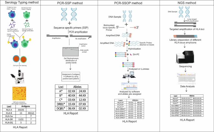 HLA Loci and Typing in Solid Organ Transplantation: A Case-Based ...