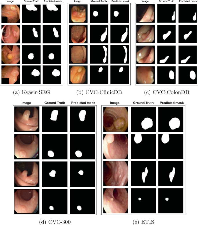 Polyp Segmentation Based on Mamba-MLP Mixer and Transformer | Springer ...