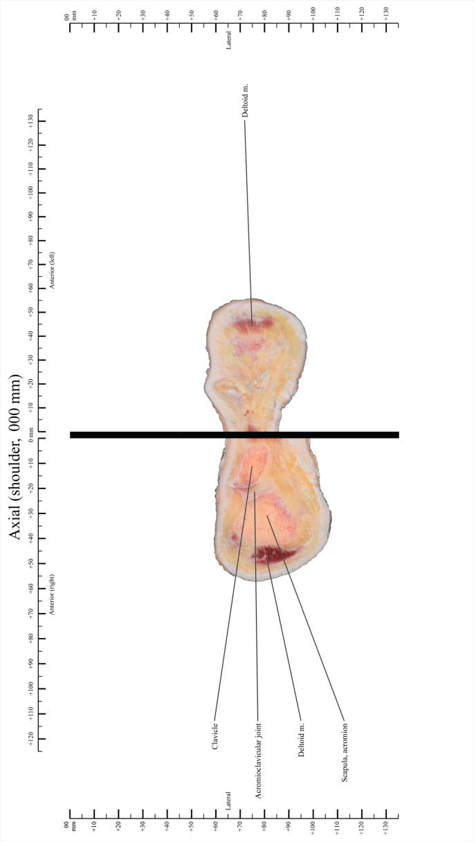 Axial Plane of Upper Limbs | Springer Nature Link