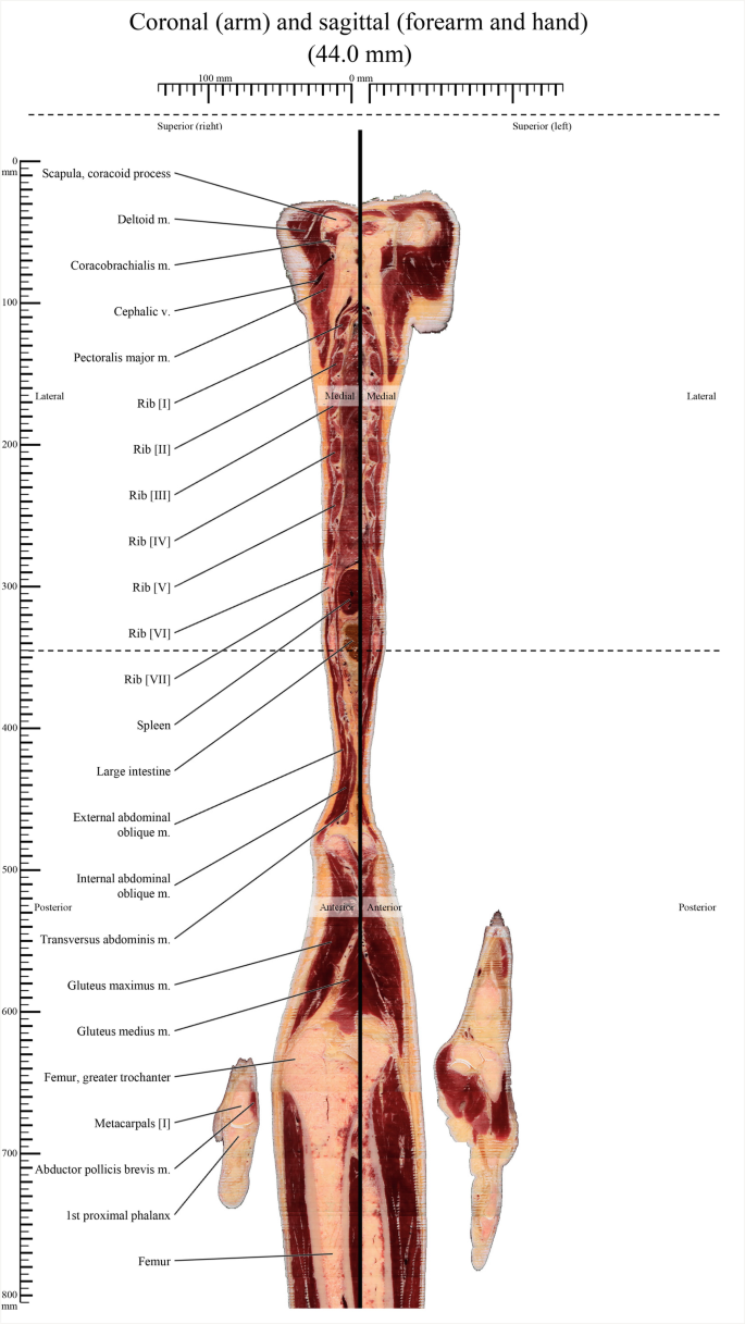 Coronal (Arm) and Sagittal (Forearm and Hand) Planes of Upper Limbs ...