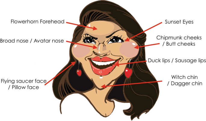 Facial Overfilled Syndrome (FOS): Pathophysiology, Diagnosis, and ...