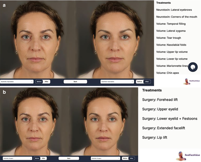 Artificial Intelligence and Injectables in Cosmetic Dermatology ...