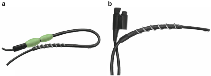 Overview of Small Bowel Enteroscopy | Springer Nature Link (formerly ...