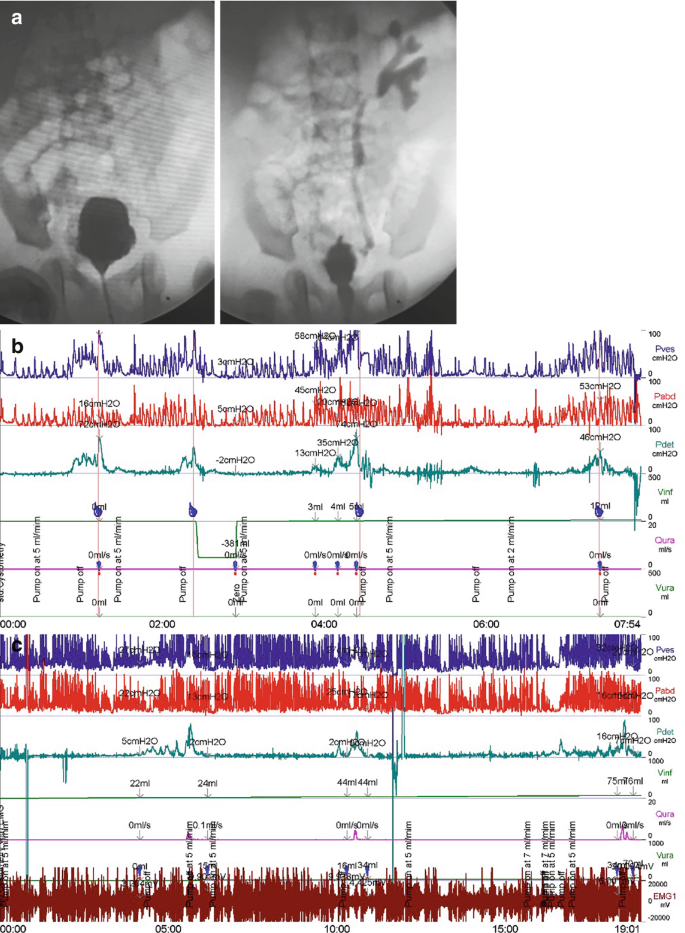 Serial UDS in Dynamic Treatment Decisions | SpringerLink