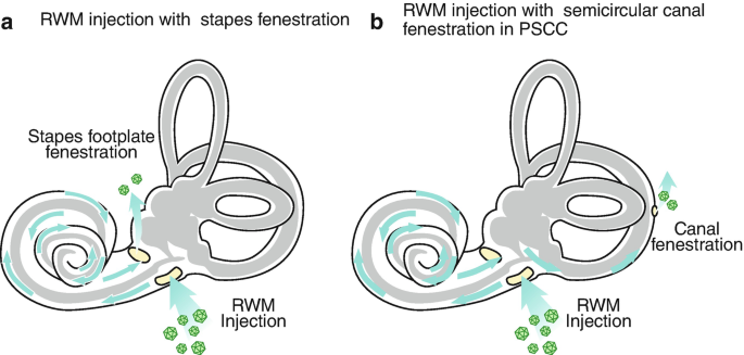 Gene Therapy and Mechanism-Based Drugs: Toward More Precise Treatment ...