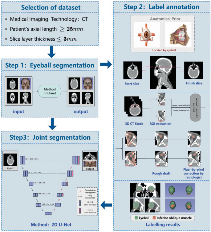 An Anatomical Priors Guided Progressive Segmentation Method for the ...