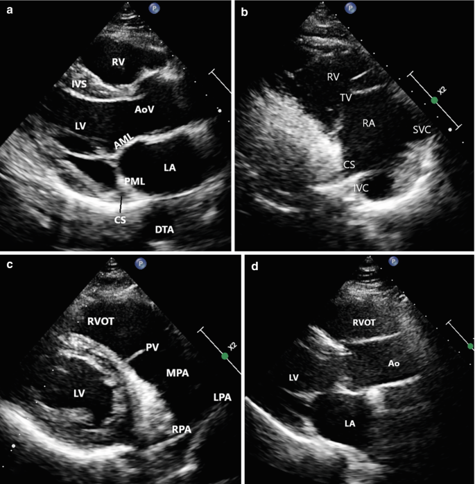 Echocardiographic Examination | SpringerLink