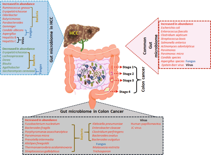 Gut Microbiome: Associations with Liver and Colon Cancer | SpringerLink