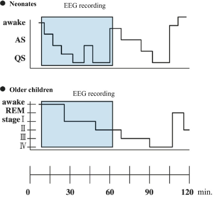 Characteristics of Neonatal EEGs | SpringerLink