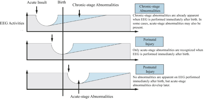 Clinical Application of EEG in the Neonatal Period | SpringerLink