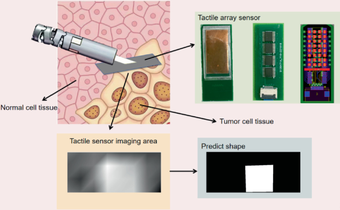 Tactile Image Processing and Shape Detection Method of Array Tactile Sensor for Surgical Robot ...