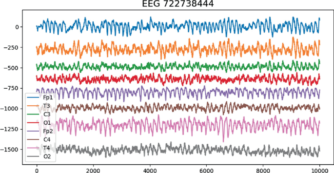 Harmful Brain Activity Classification Through Deep Learning the ...