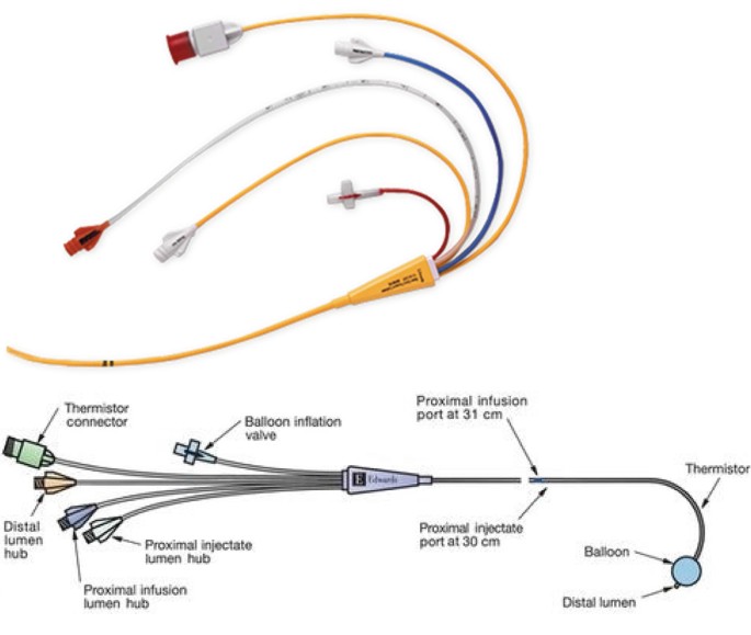 Swan Ganz Catheter Insertion | SpringerLink