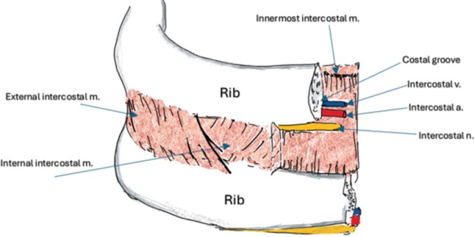 Intercostal Drainage | SpringerLink