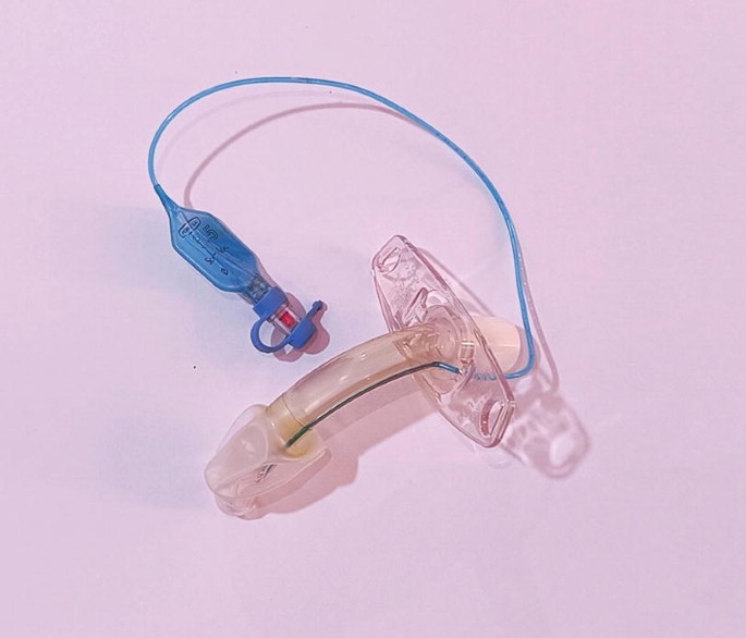 Tracheostomy | SpringerLink