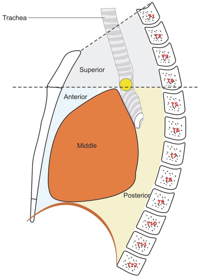 Mediastinal Masses in Children | Springer Nature Link